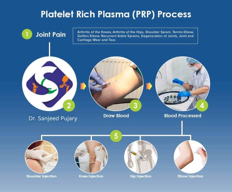Platelet-Rich Plasma (PRP) Injections - DR.SANJEED PUJARY